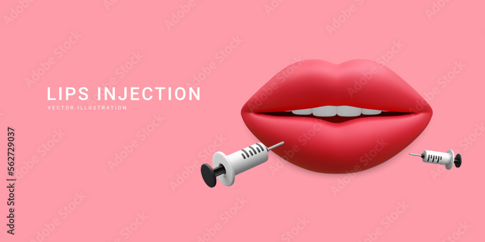 3d realistic banner for lip injection. Concept of dermatology and ...