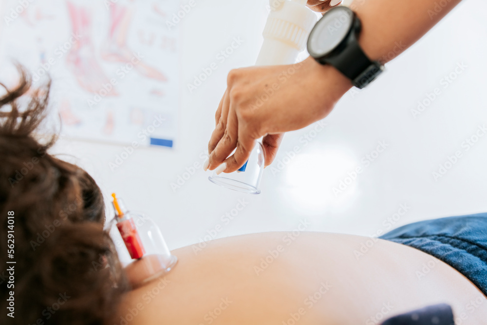 Physiotherapist placing cupping on patient, Professional physiotherapy ...