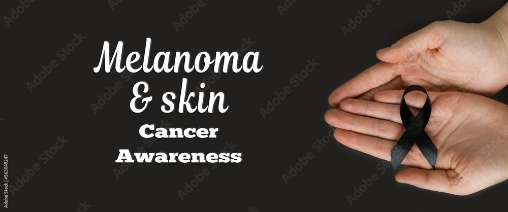 Woman holding black Ribbon. Symbol Melanoma and skin cancer. Stock ...