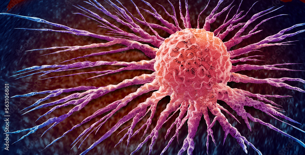 Cancer Cell Spread and oncology or Malignant Cancerous Growth and ...