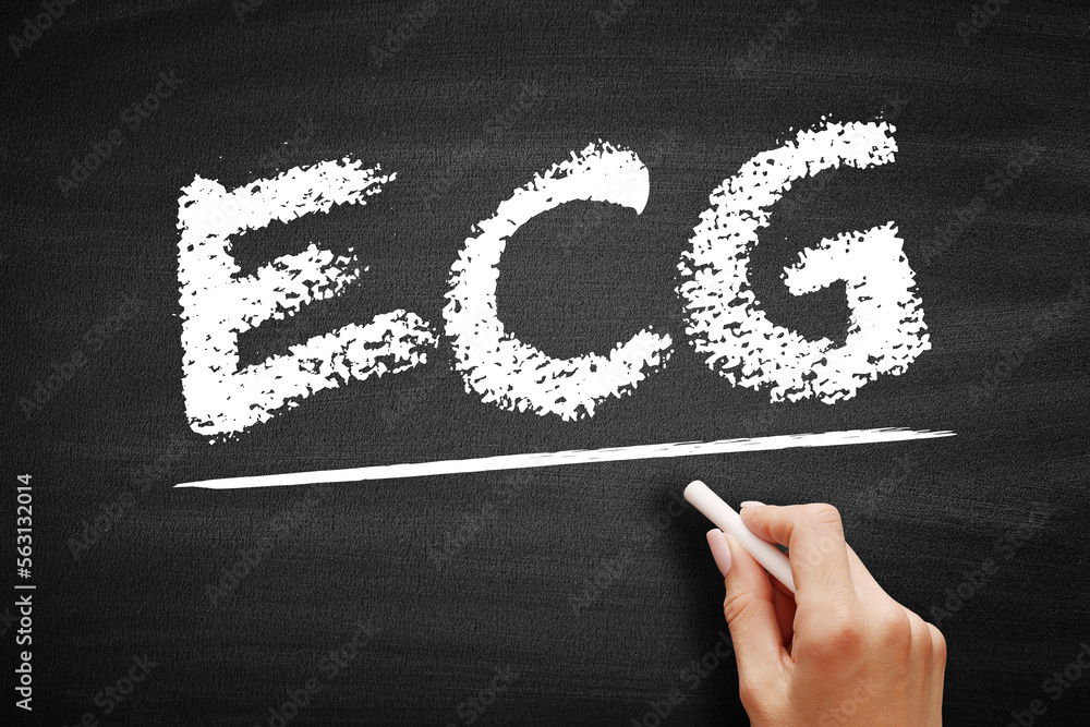 ECG Electrocardiogram - simplest and fastest tests used to evaluate the ...