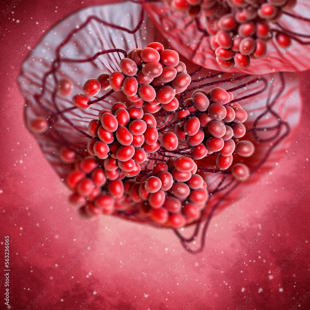 Medical background, Staphylococcus aureus, a type of spherical gram ...