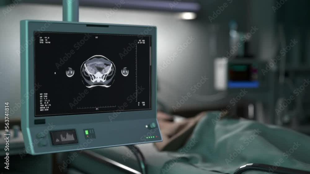 Scanner Examining Human Body To Diagnose Medical Condition Of Patient ...