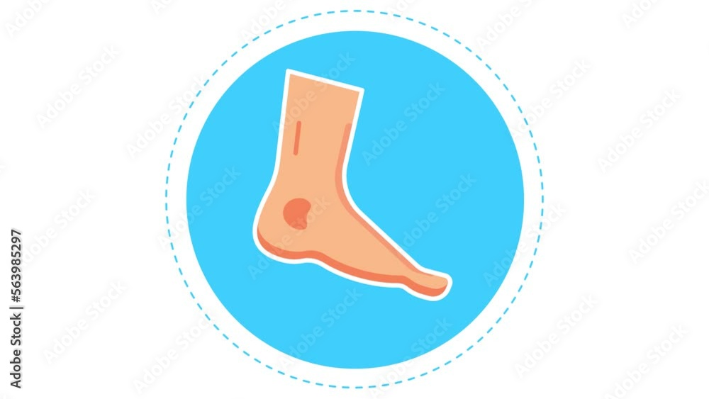 Ankle Pain injury in human body healthcare concept animation Stock ...