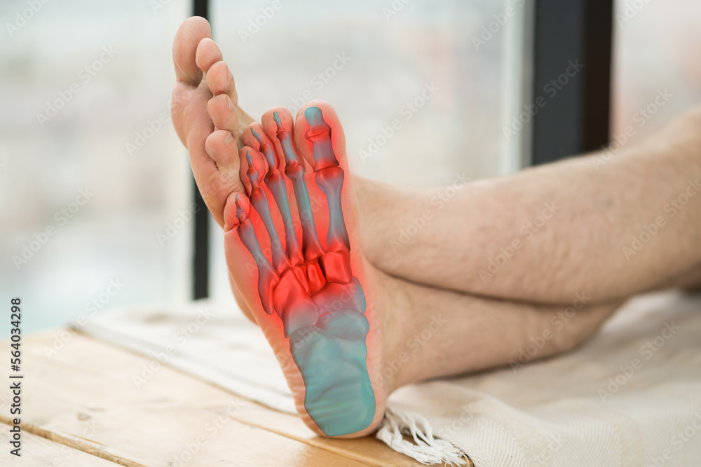 Joint diseases, hallux valgus, plantar fasciitis, man's leg hurts, pain ...