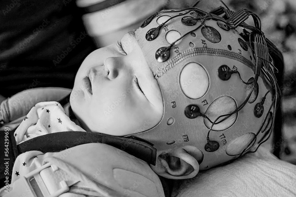 Electrical activity of the brain. Children's health. A sleep child EEG ...
