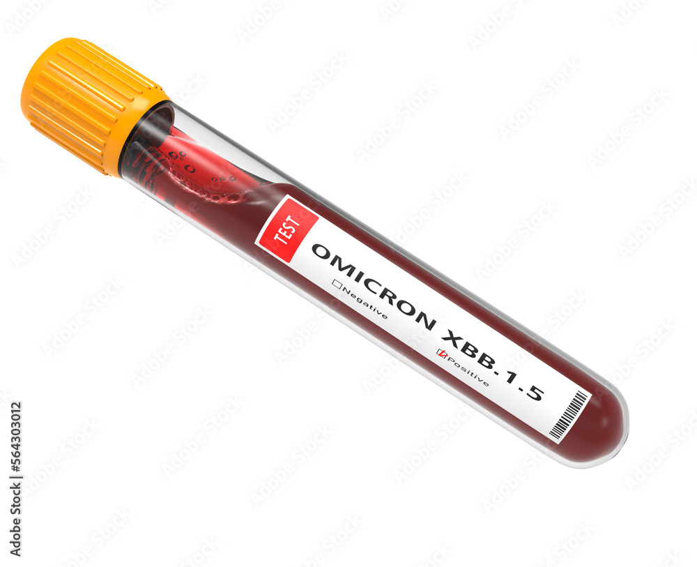 Test tube of SARS-CoV-2 Omicron XBB.1.5, positive result. Transparent ...