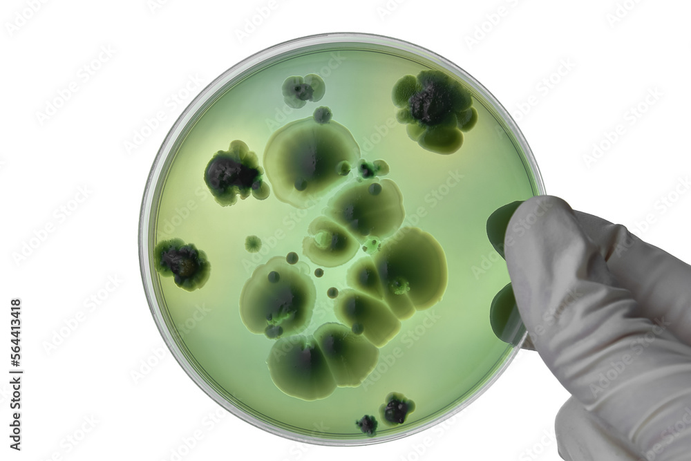 Hand with Petri dish or culture media with bacteria on white background ...
