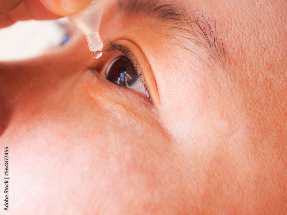 Closeup asian woman applying eye drop artificial tears treatment dry ...
