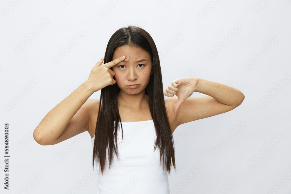 Asian woman facial skin problems, acne and inflammation, red rashes and ...