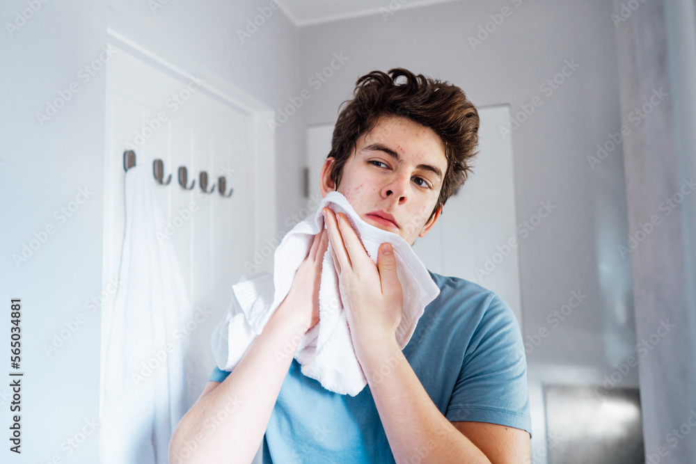 Concentrated caucasian teenage boy with acne problem take care his face ...