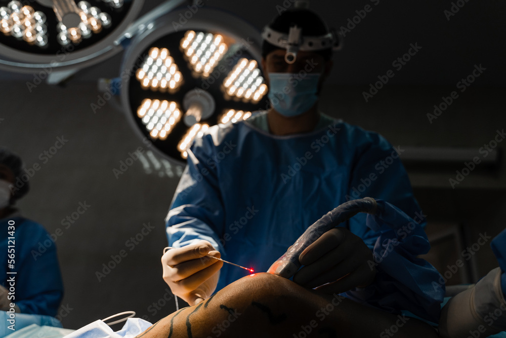 Vascular surgeon is operating leg using EVLT Red laser optical fiber ...