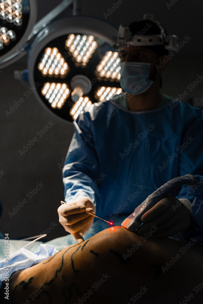 Vascular surgeon is operating leg using EVLT Red laser optical fiber ...