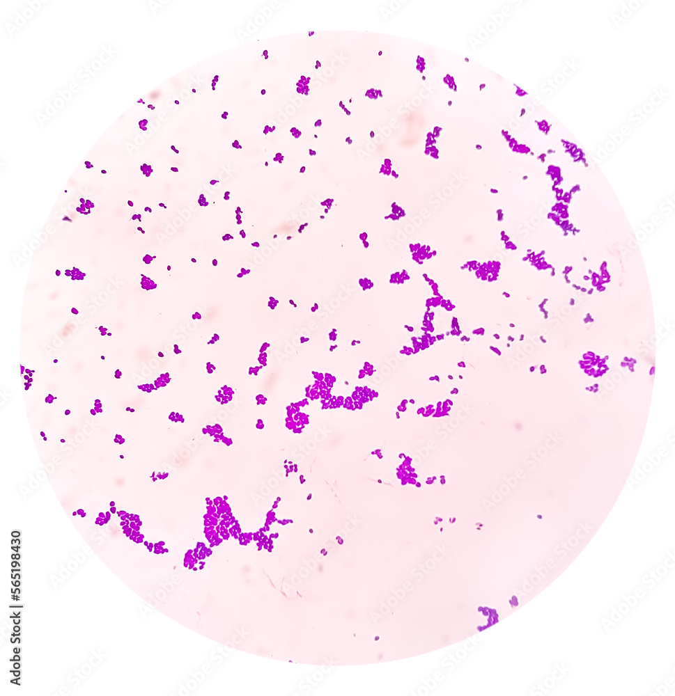 Candida Spp colony under microscopic view. Candida albicans. Fungal ...