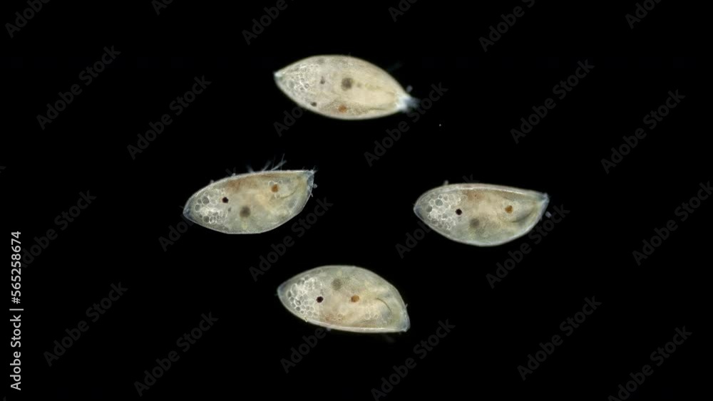 Cypris larva genus Balanus under microscope, family Balanidae. Attaches ...