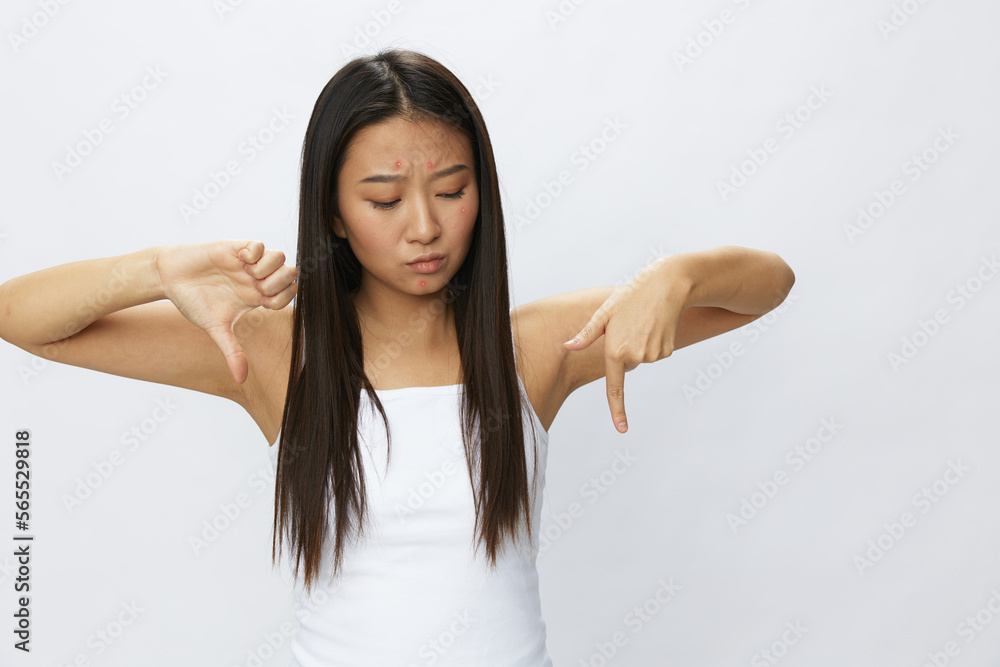 Asian woman facial skin problems, acne and inflammation, red rashes and ...