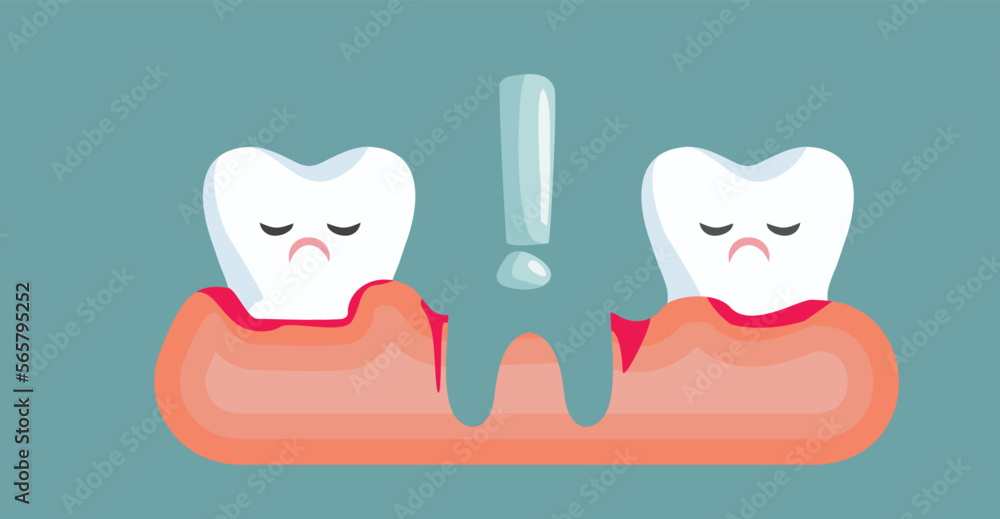 Tooth Loss in Oral Health Concept Medical Cartoon Illustration. Teeth ...