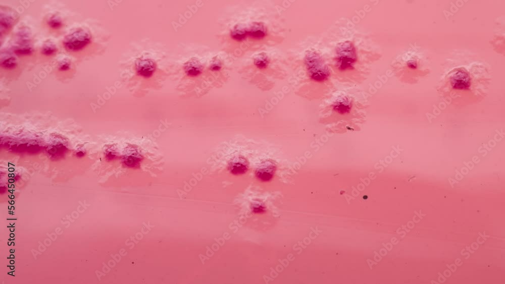 Escherichia coli colonies growing on MacConkey agar in a petri dish ...