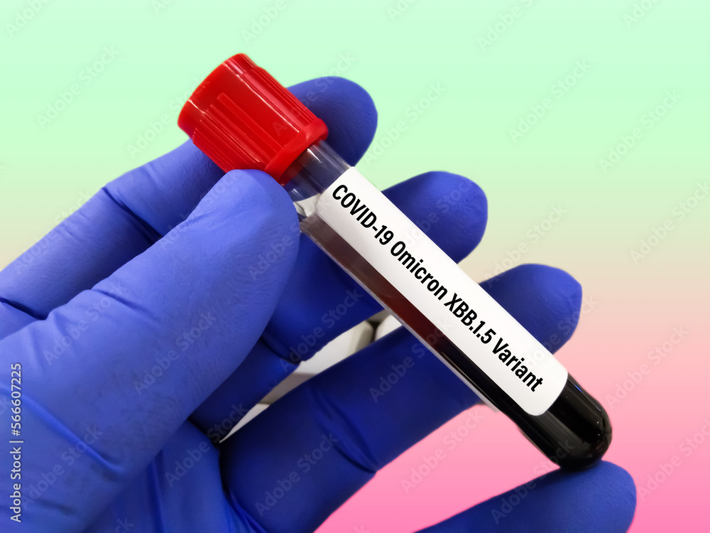 Blood sample for SARS-COV-2, COVID-19 Omicron XBB.1.5 variant test. The ...
