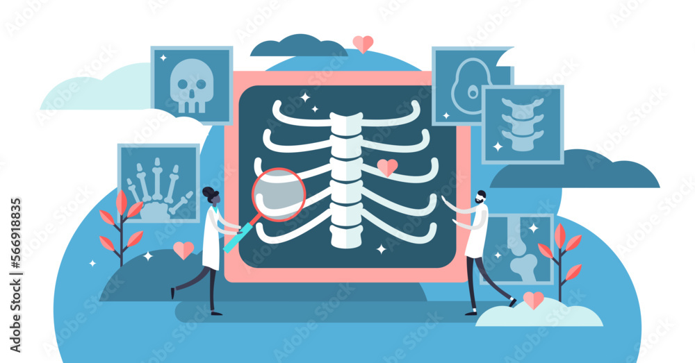 Radiology illustration, transparent background.Flat tiny xray skeleton ...