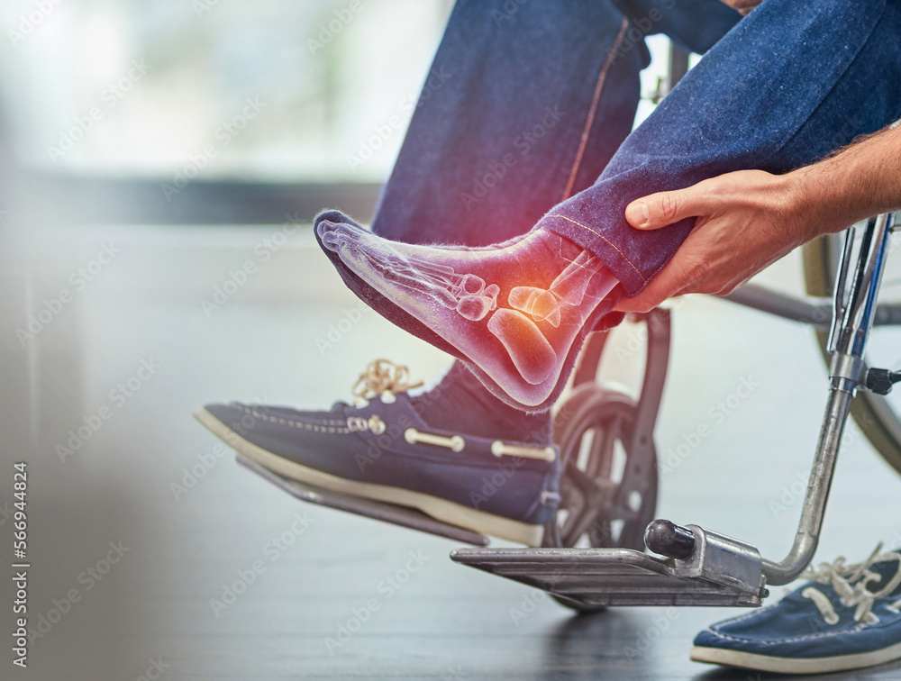Stockfoto Closeup, man in wheelchair and foot injury with pain ...
