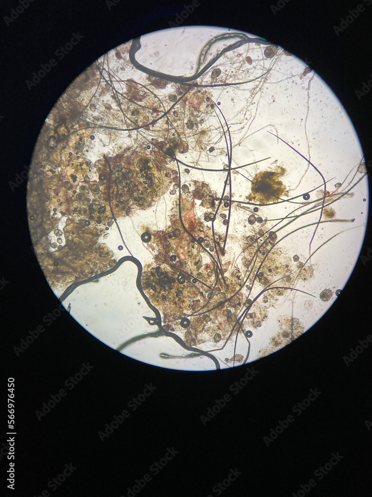 Notoedres cati under the microscope. Notoedric mange, also referred to ...