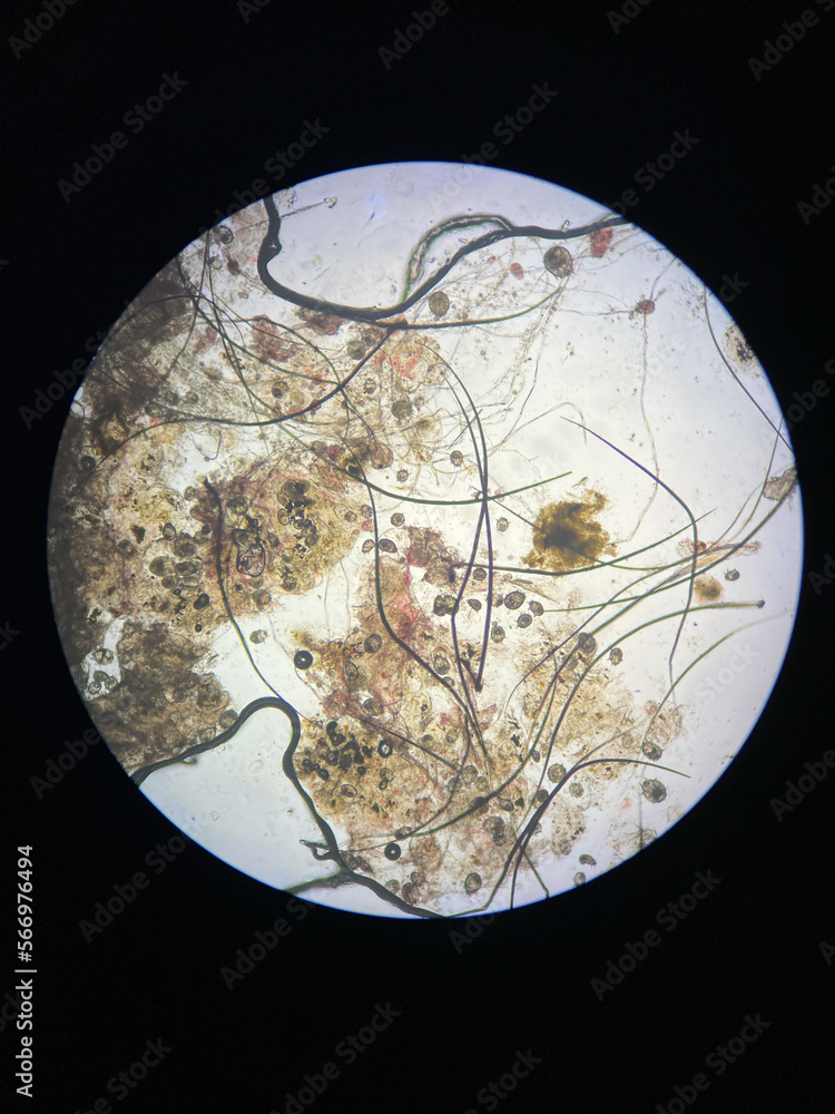 Notoedres cati under the microscope. Notoedric mange, also referred to ...