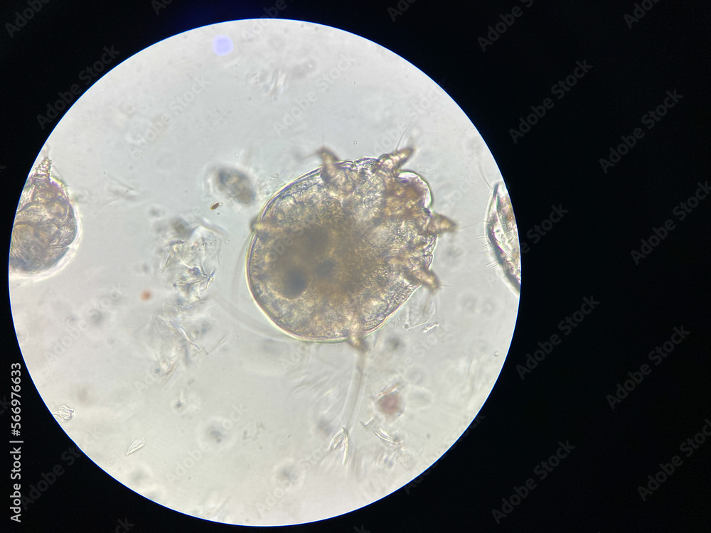 Notoedres cati under the microscope. Notoedric mange, also referred to ...