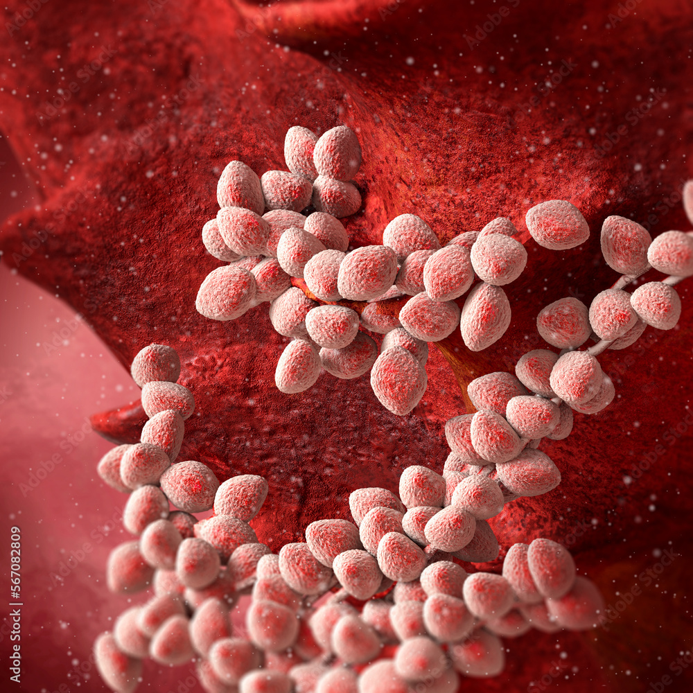 Medical background, Staphylococcus aureus, a type of spherical gram ...