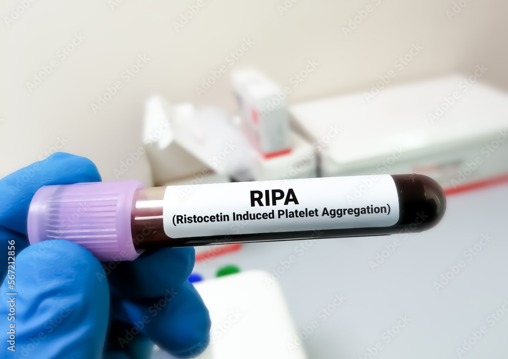 Ristocetin-induced platelet aggregation (RIPA) test, used to determine ...