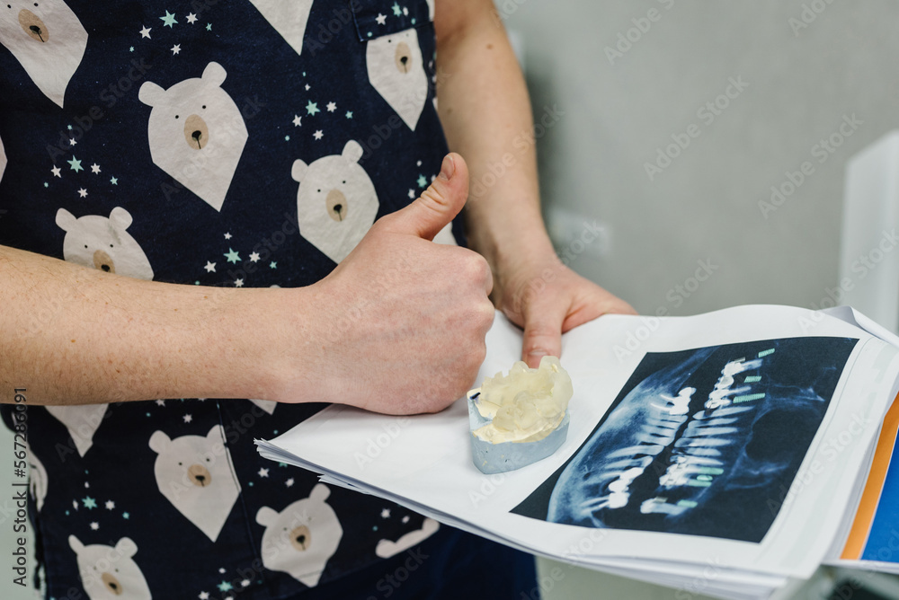 X-ray image. Doctor presenting photo with tooth x-ray film in treatment ...