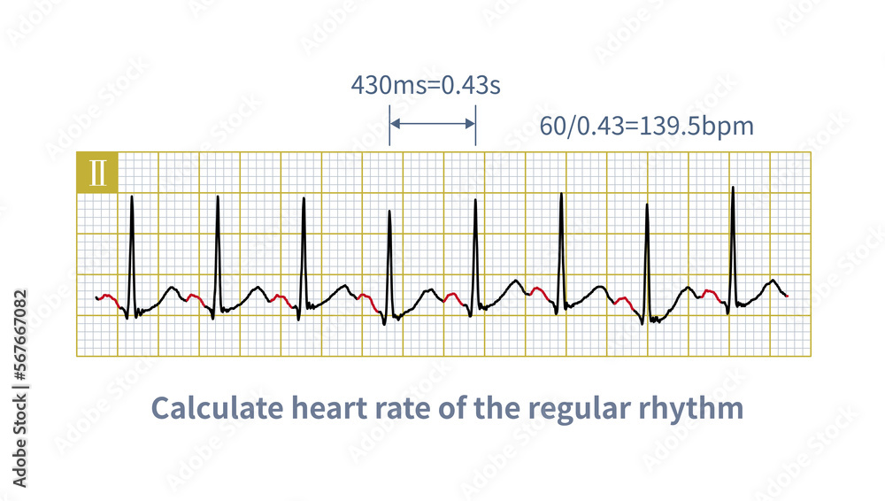 In daily work, the horizontal 1 mm represents 40 ms of time in the ...