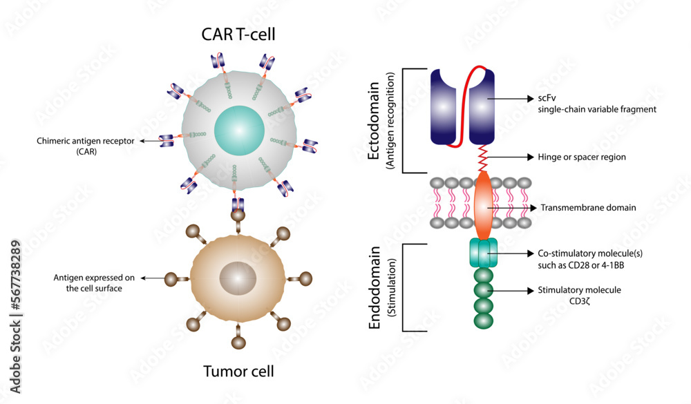 CAR T-cell therapy and Cancer treatment . Chimeric antigen receptor T ...