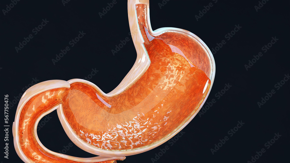 Stomach Acid Relux. Esophagus, gerd. Pain In The Digestive System ...