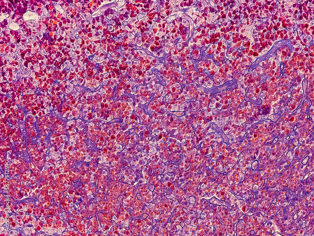 guinea pig hypophysis (pituitary gland) under the microscope, anterior ...