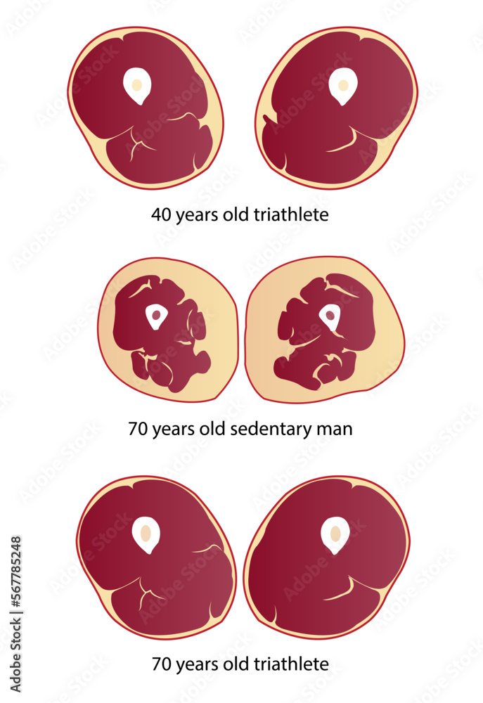 Comparison of muscle mass and strength vector illustration isolated on ...
