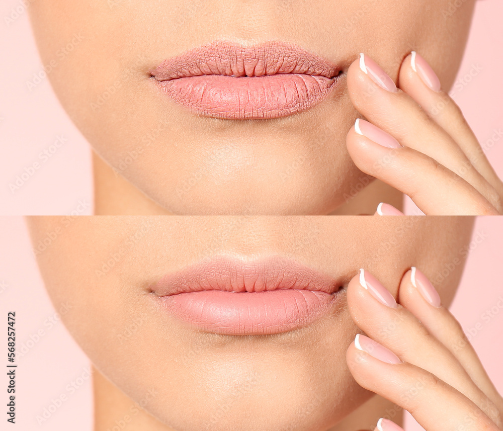 Collage with photos of woman before and after using lip balm on pink ...