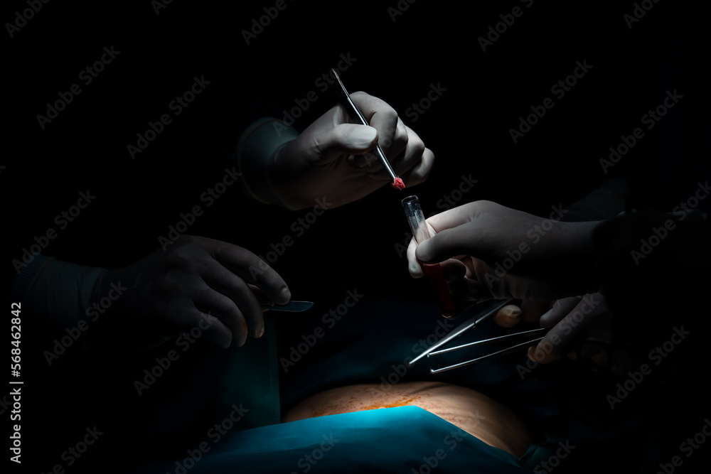 Closeup surgical team performing surgery to patient in sterile ...