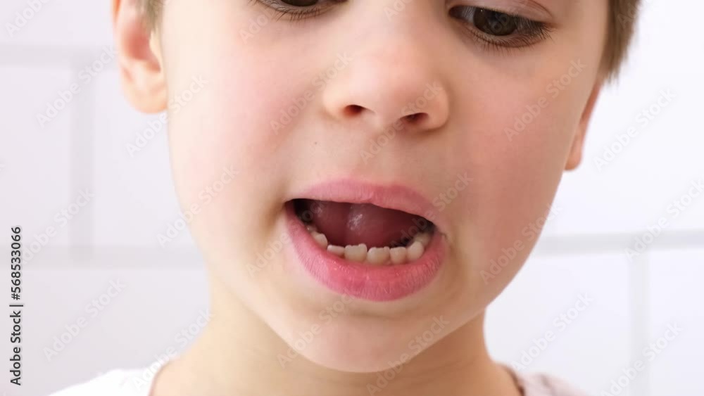 Child shows his loose milk tooth presses and pushes it with his tongue ...