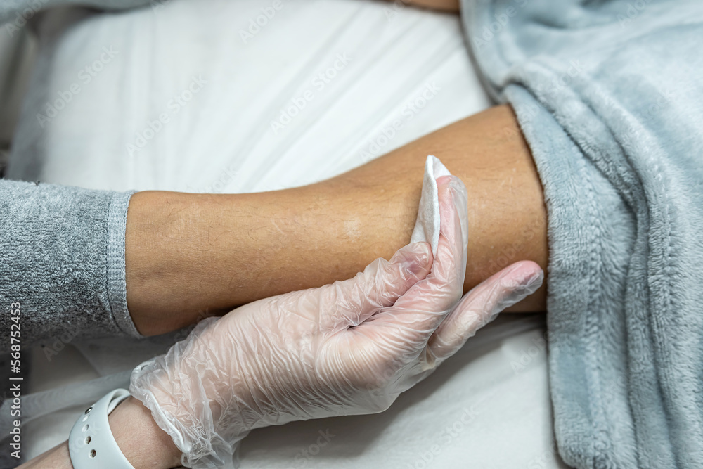 Doctor doing electroepilation procedure for removal hair from woman's ...
