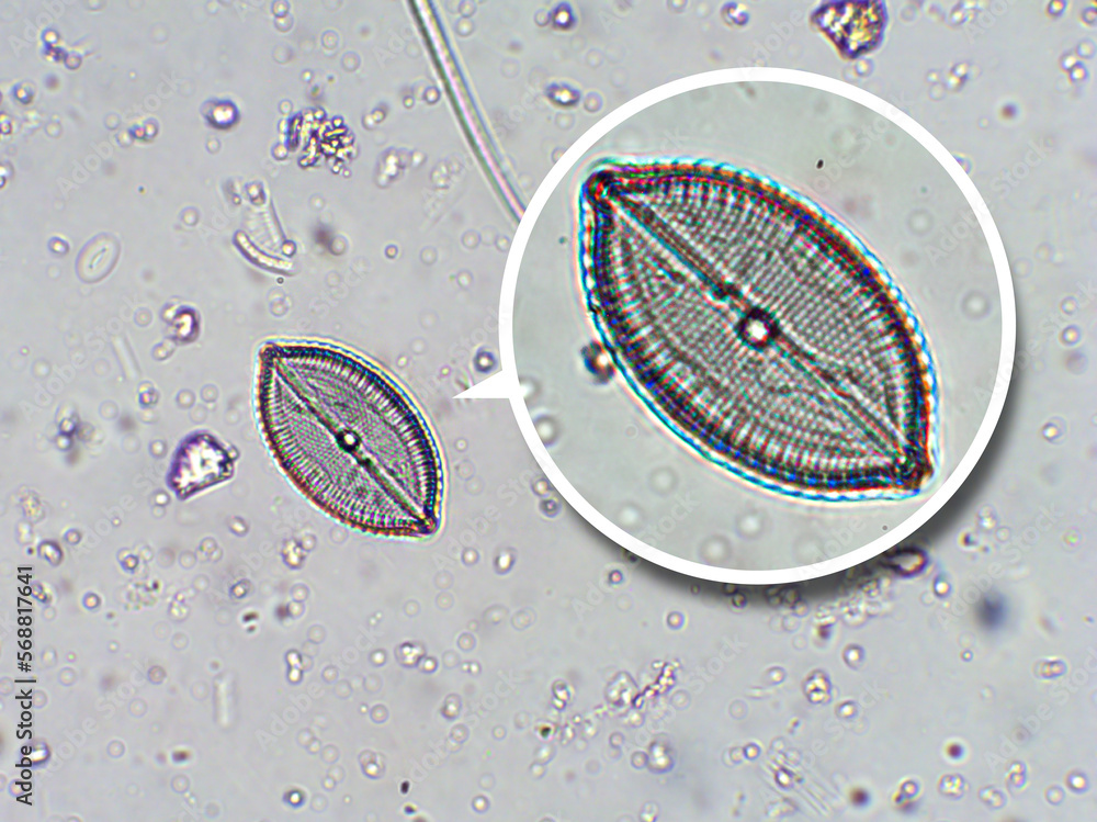 Diatoms, algae under microscopic view, phytoplankton, fossils, silica ...
