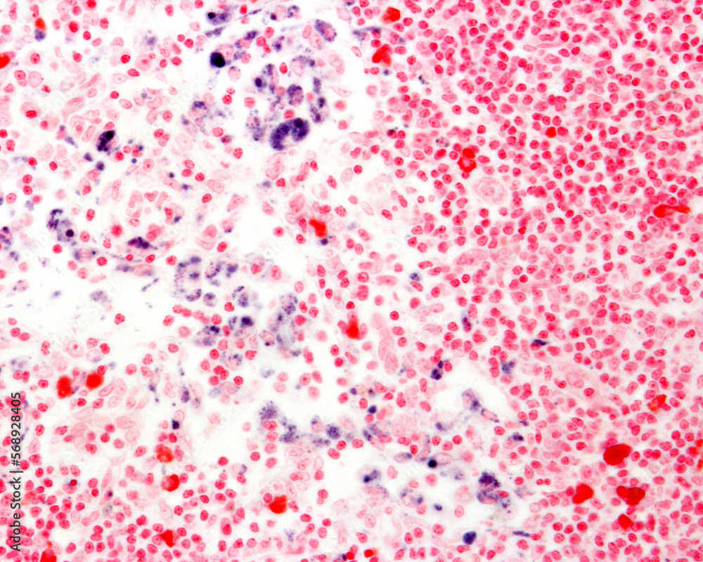 Lymph node macrophages labelled with Trypan blue Stock Photo | Adobe Stock