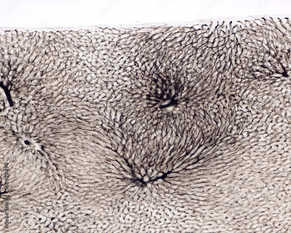 Liver. Blood vessels labelled with Indian ink Stock Photo | Adobe Stock