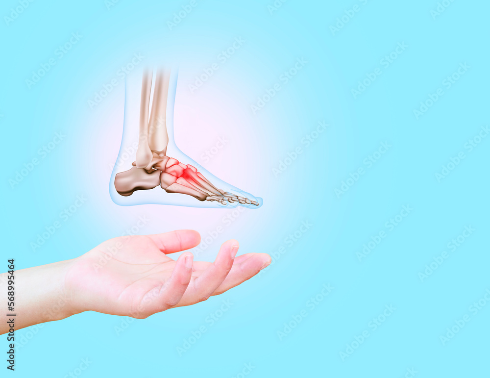 Foot pain, upper part, inflammation, arthritis, osteosarcoma, gout ...