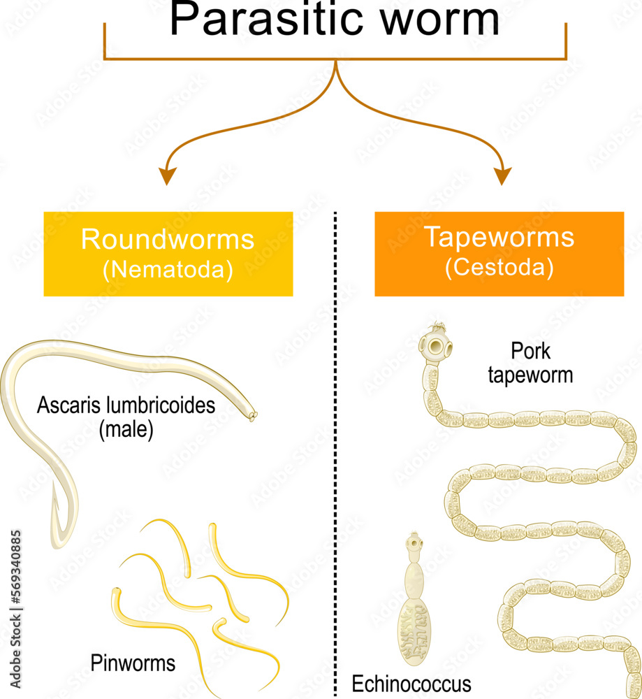 worm infection. Helminthiasis. Common types of parasitic worms or ...