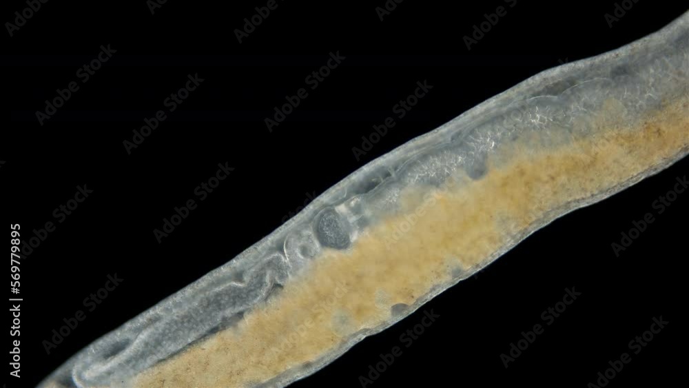 Nemertea worm under a microscope, class Hoplonemertea, order ...