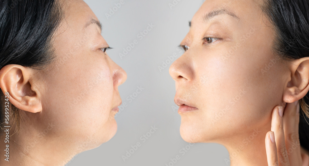 Part of face, Asian woman with double and perfect chin isolated on ...