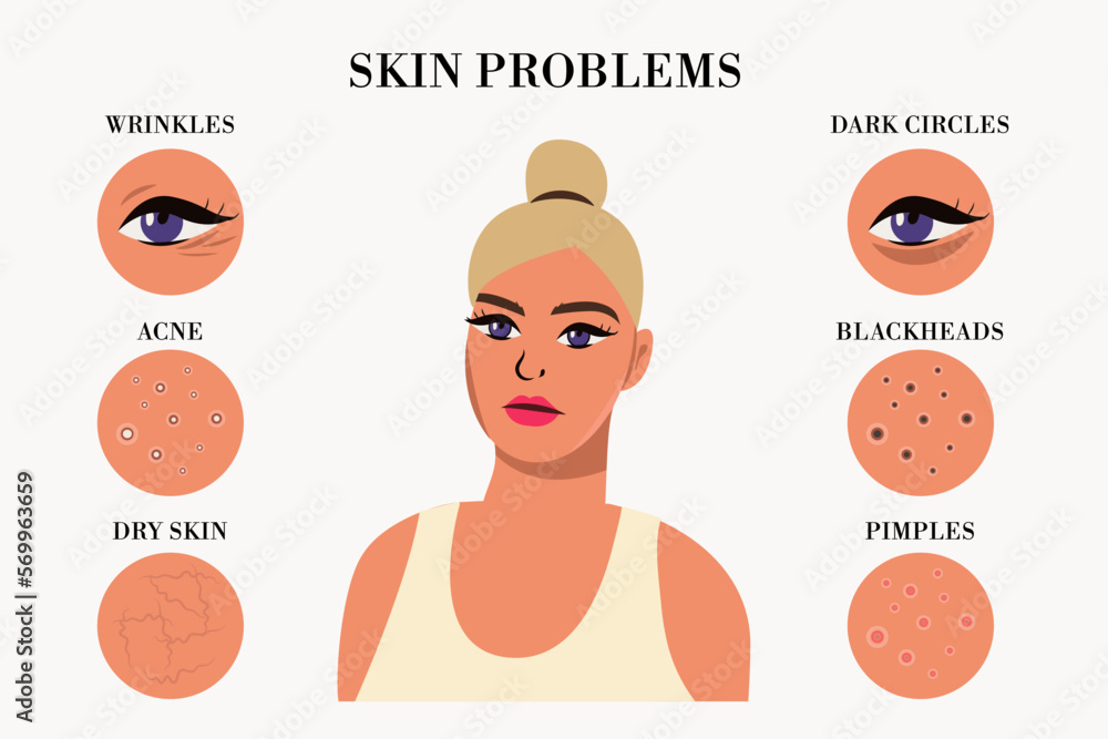 sad woman and set of most common female facial skin problems needs to ...