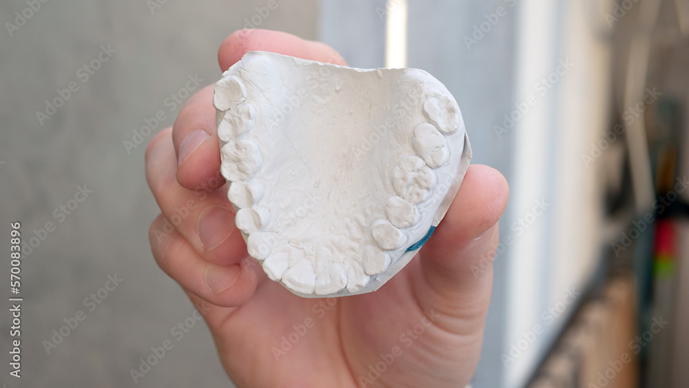 Demonstration model Plaster teeth of a man in the hands of a man, teeth ...