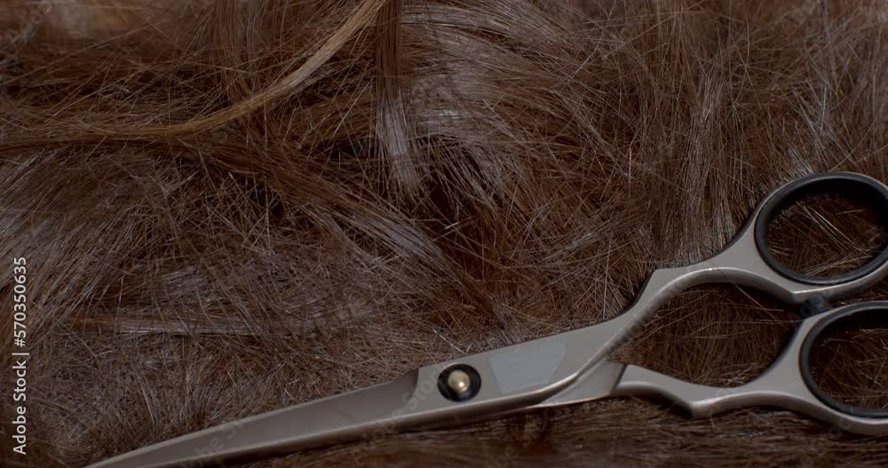 Cropped hair of a person infested with lice and nits parasite. Shedding ...